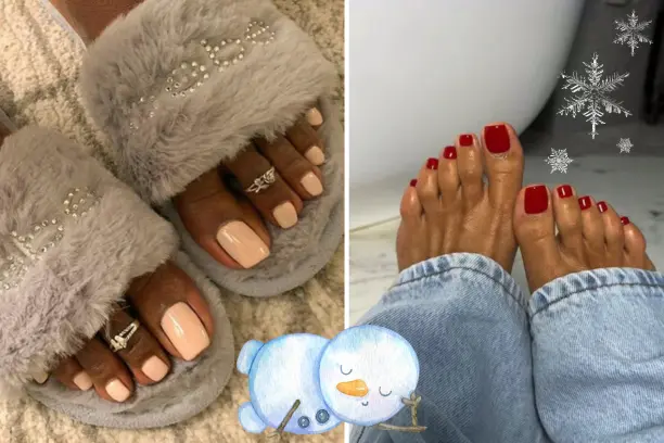 13 Winter Toenail Colors for Dark Skin Tones Perfect for Cold Days