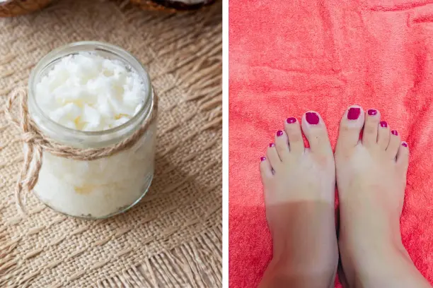 Homemade Foot Mask for Dry Feet - Moisturize & Smoothens